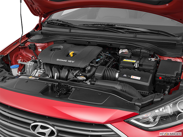 2017 Hyundai Elantra Sport: Price, Review, Photos and Specs - Read This ...